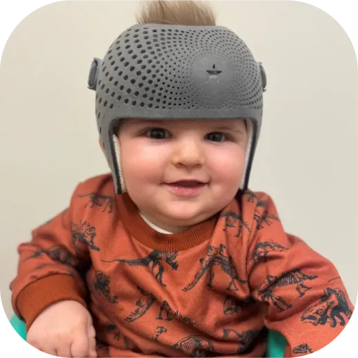 AddiShield | Custom Cranial Helmets for Head Deformity Treatment