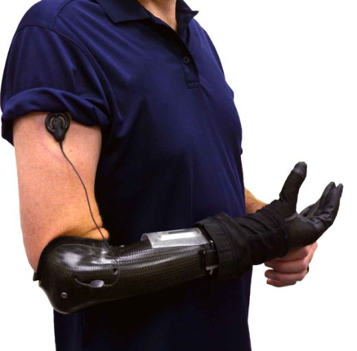 Upper Extremity Prosthetic Sockets | AddiEase by Addiwise