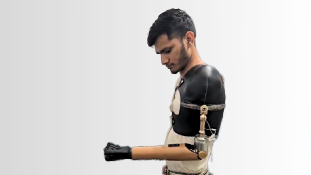 Upper Extremity Prosthetic Sockets | AddiEase by Addiwise